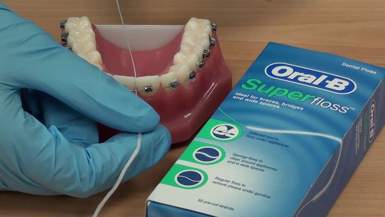 Everything You Need to Know About Superfloss: The Ultimate Guide to ...